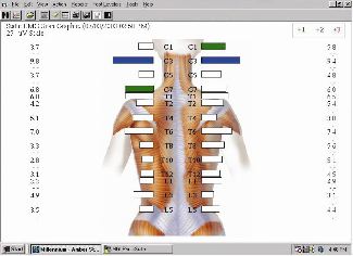 Chiropractic Advanced Technology in Phoenix, AZ | Toyos Chiropractic